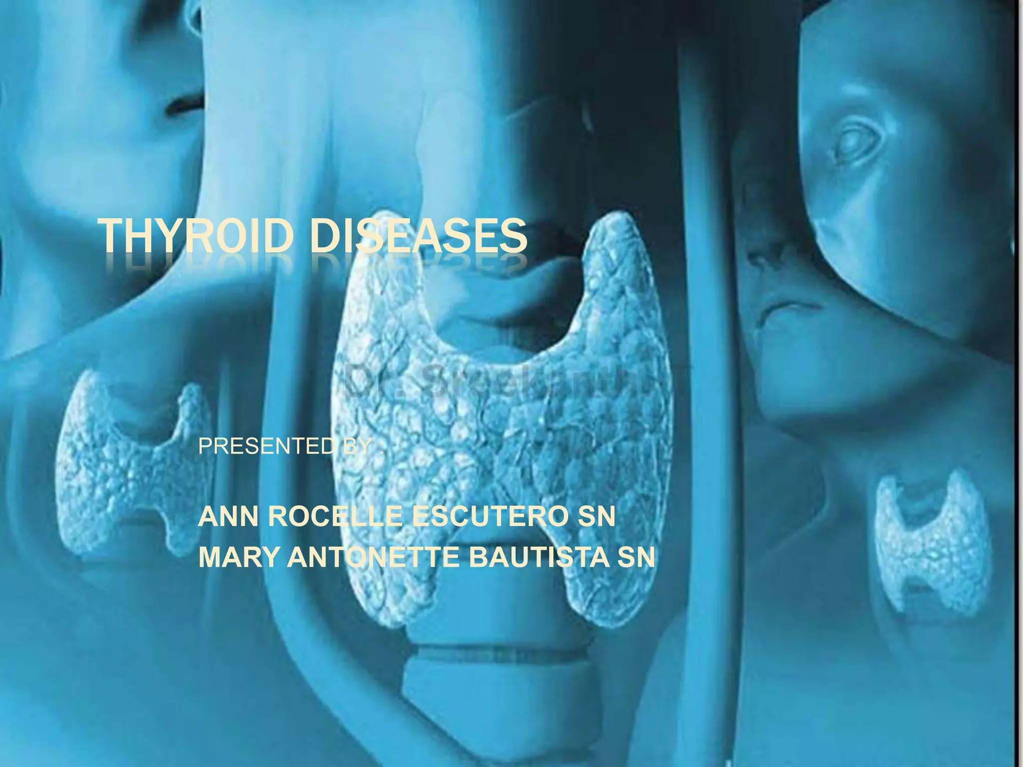Thyroid disease | PPTX