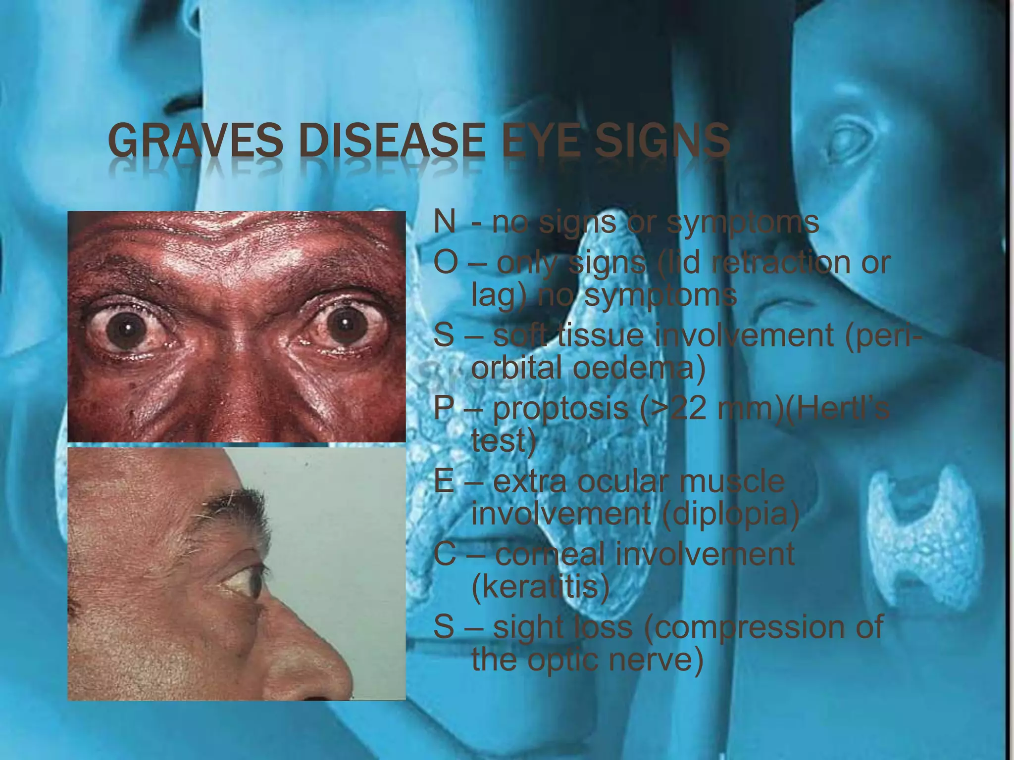 Thyroid disease | PPTX