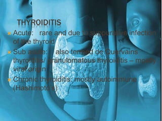 Thyroid disease | PPTX