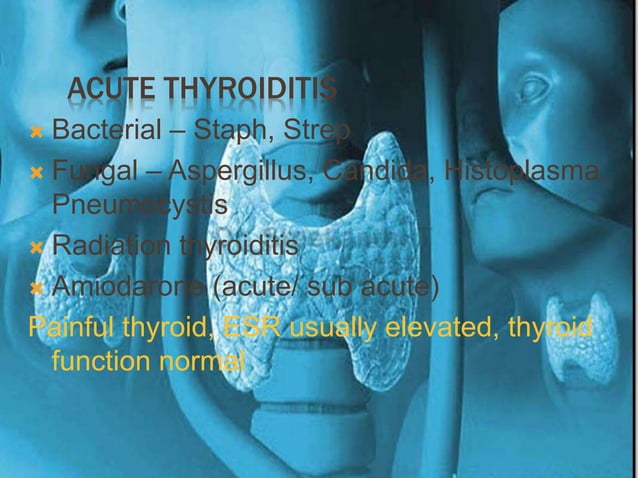 Thyroid disease | PPT