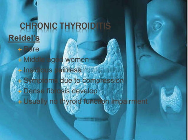 Thyroid disease | PPT