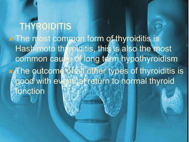 Thyroid disease | PPT