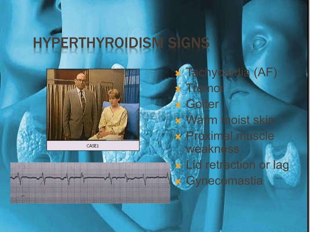 Thyroid disease | PPT