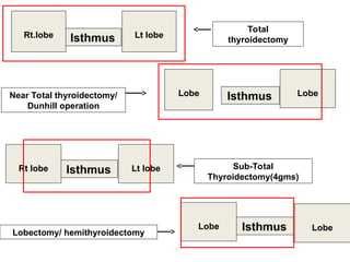 Thyroid Disease jshshwjsgsjwhsjwkwkwkw.ppt