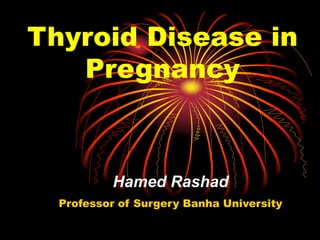 Thyroid disease in pregnancy lecture.ppt