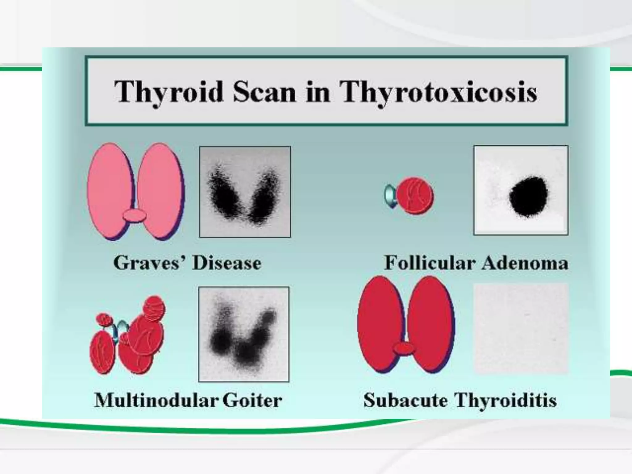 Thyroid Diseases.ppt