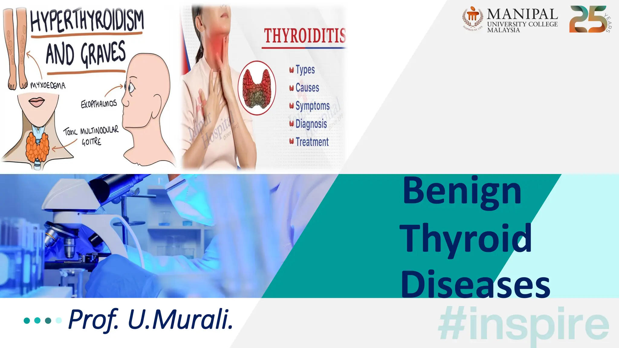 Benign Diseases of Thyroid - C/F & Management | PPT