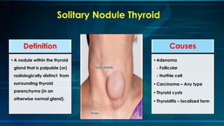 Benign Diseases of Thyroid - C/F & Management | PDF
