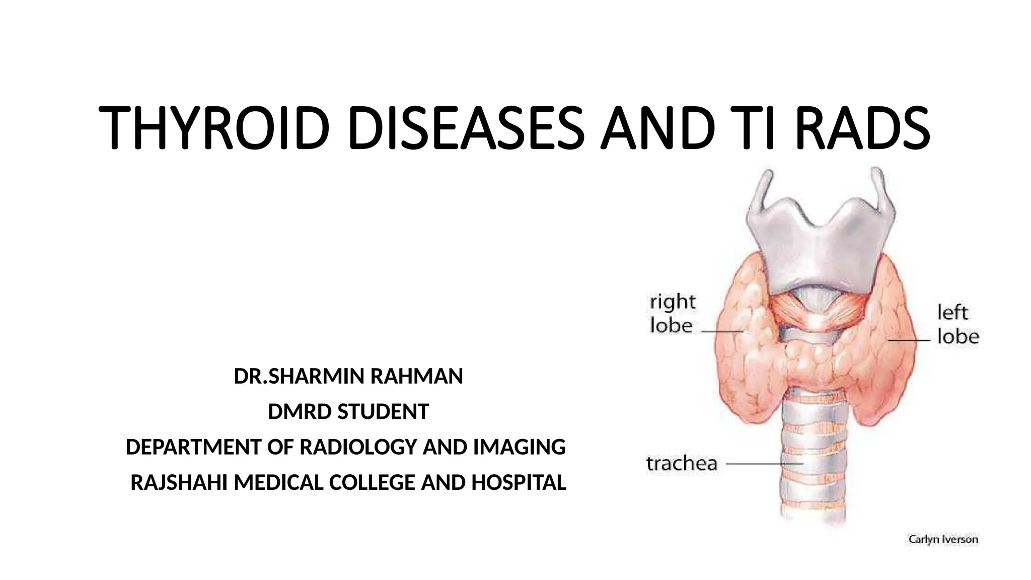 THYROID DISEASES AND TI RADS presentation.pptx