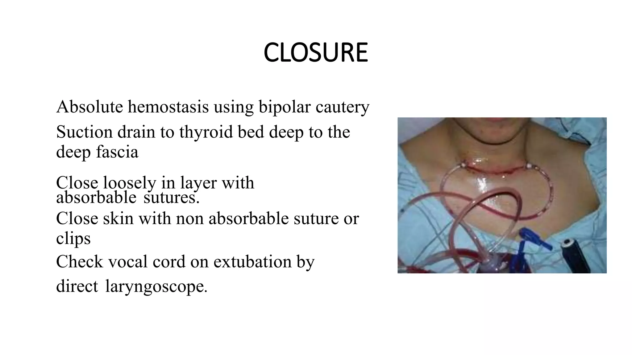 thyroid diseases navya.pptx