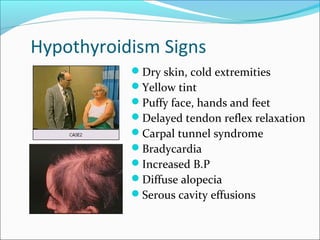 Thyroid disorders | PPT