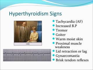 Thyroid disorders | PPT