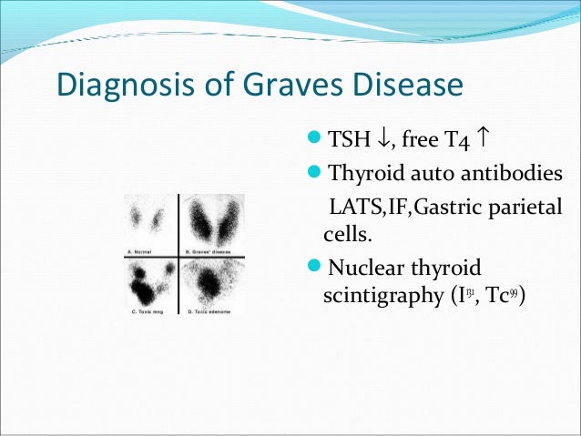 What Is The Icd 10 Code For Thyroidectomy
