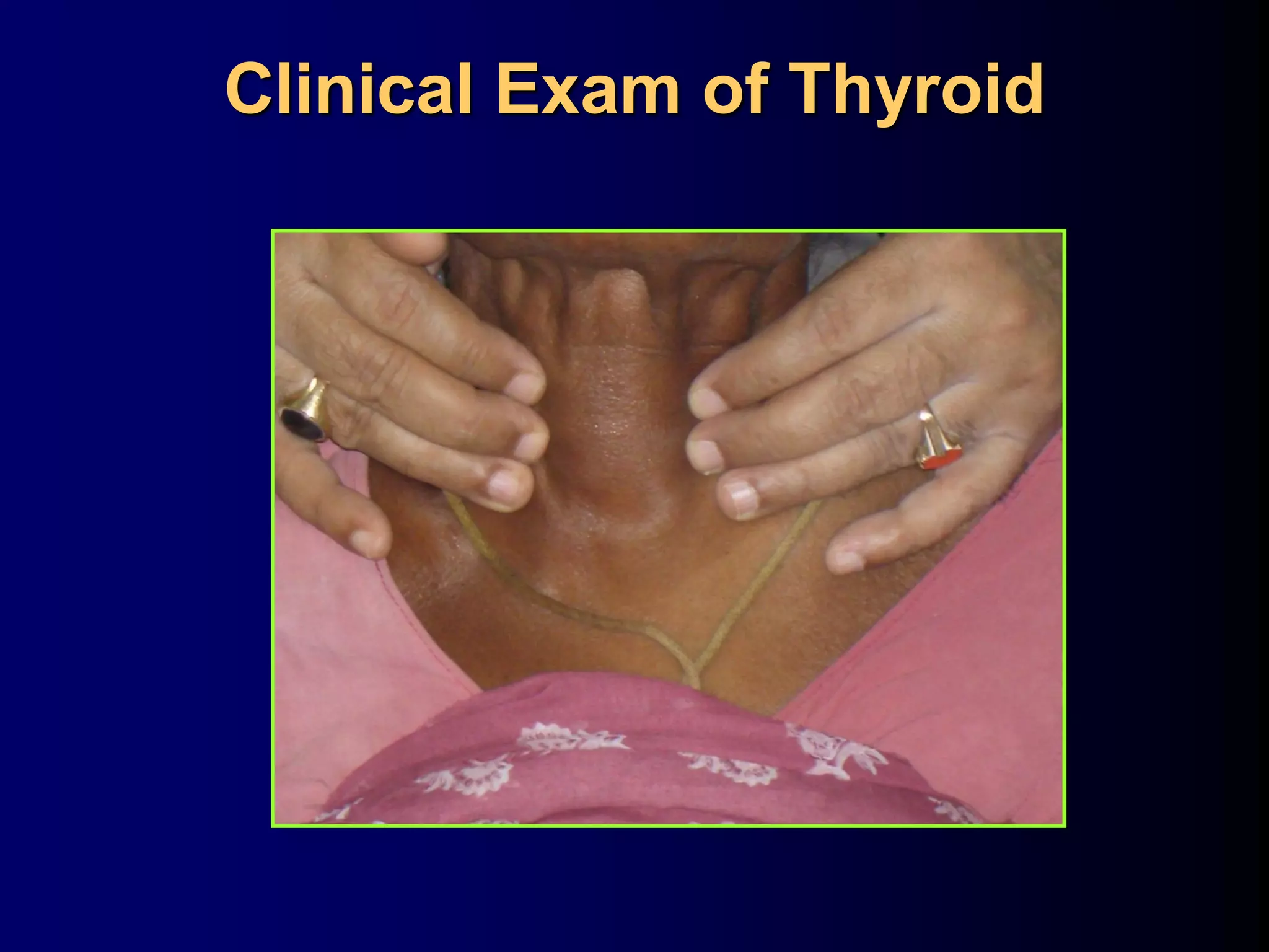 Thyroid disorders (hyperthyroidism & hypothyroidism) | PDF