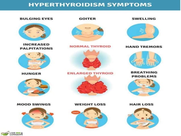 thyroid disorders.pptx