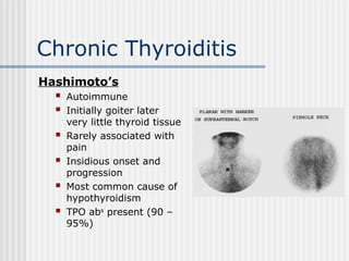 Thyroid disorders/diseases, a medical lecture.ppt