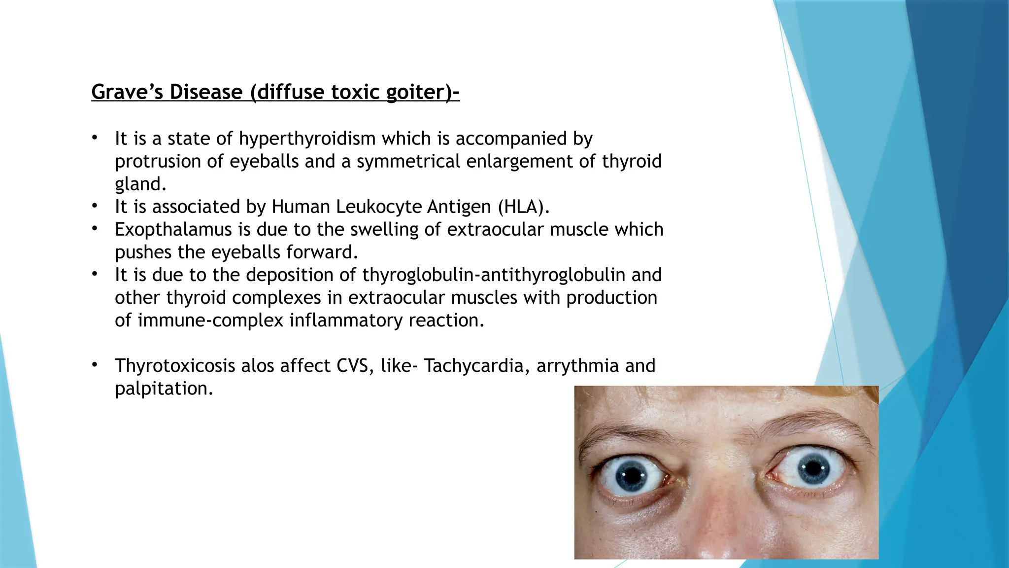 thyroid disorders.pptx, types, flowchart, clinical manifestation, hyper ...
