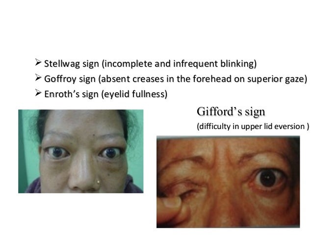 Thyroid disorders Part 1