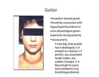 Thyroid disorders in children | PDF