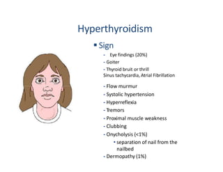 Thyroid disorders in children | PDF