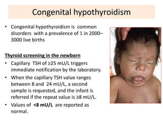 Congenital Hypothyroidism Adults