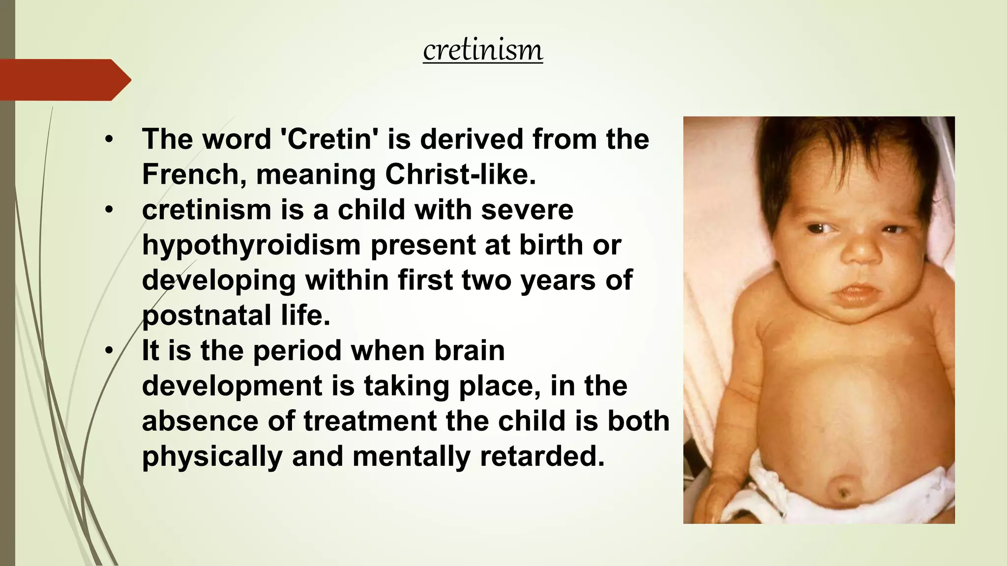 Thyroid disorder's | PPTX