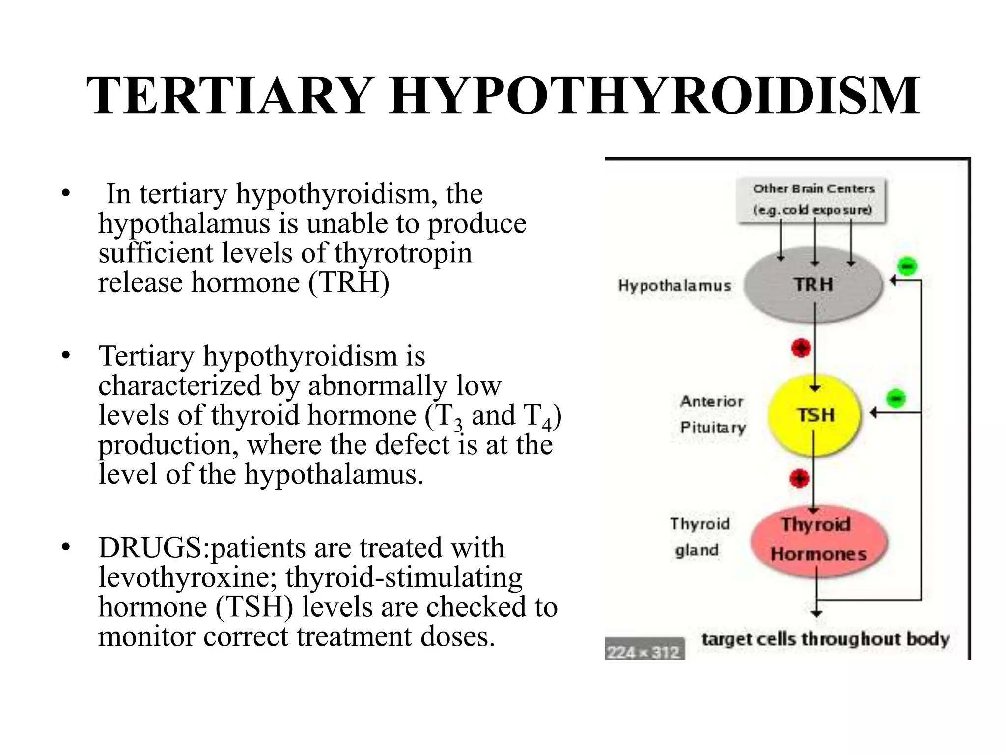 Thyroid drugs and anti thyroid drugs | PPTX