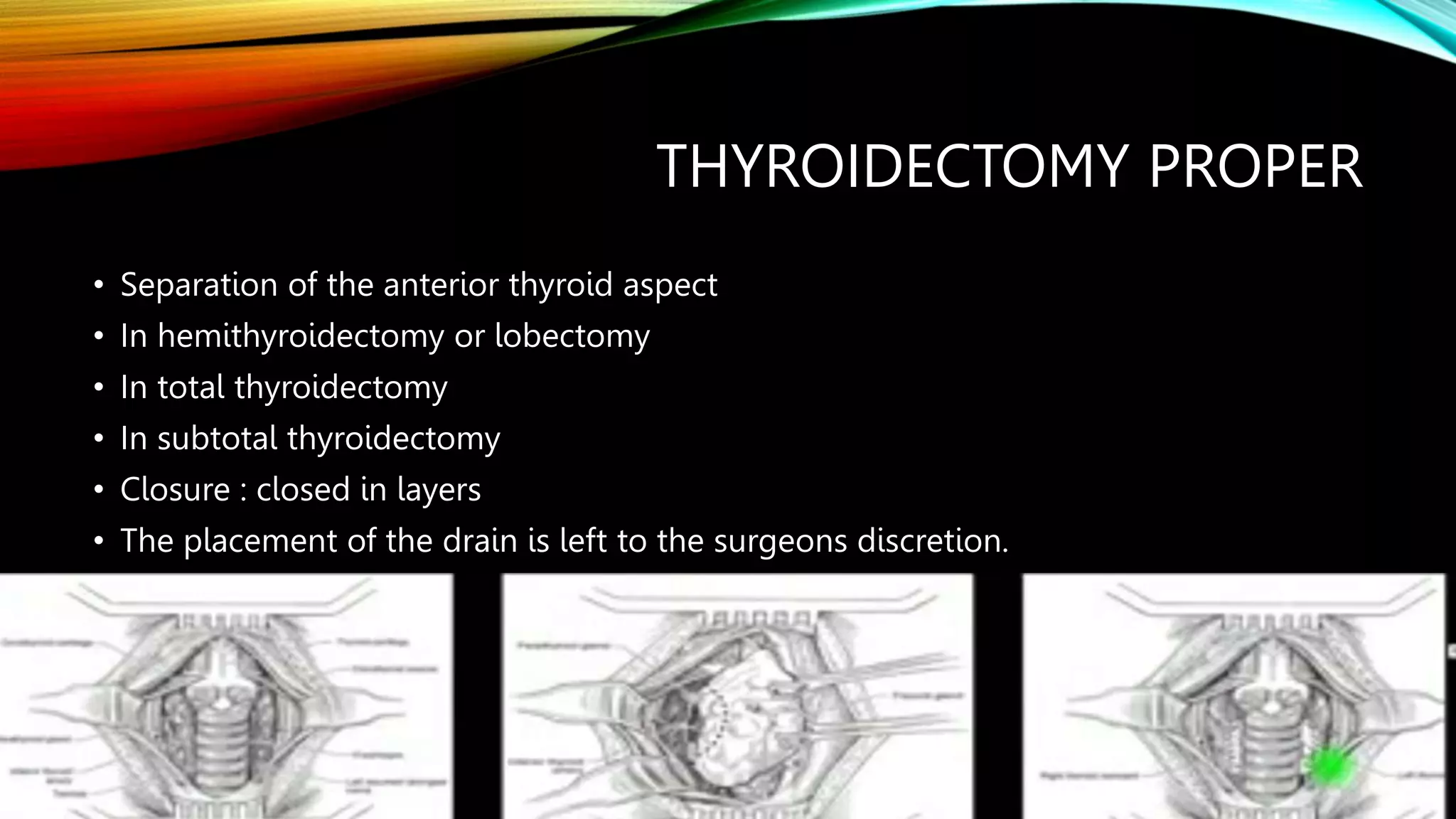 thyroidectomy.pptx