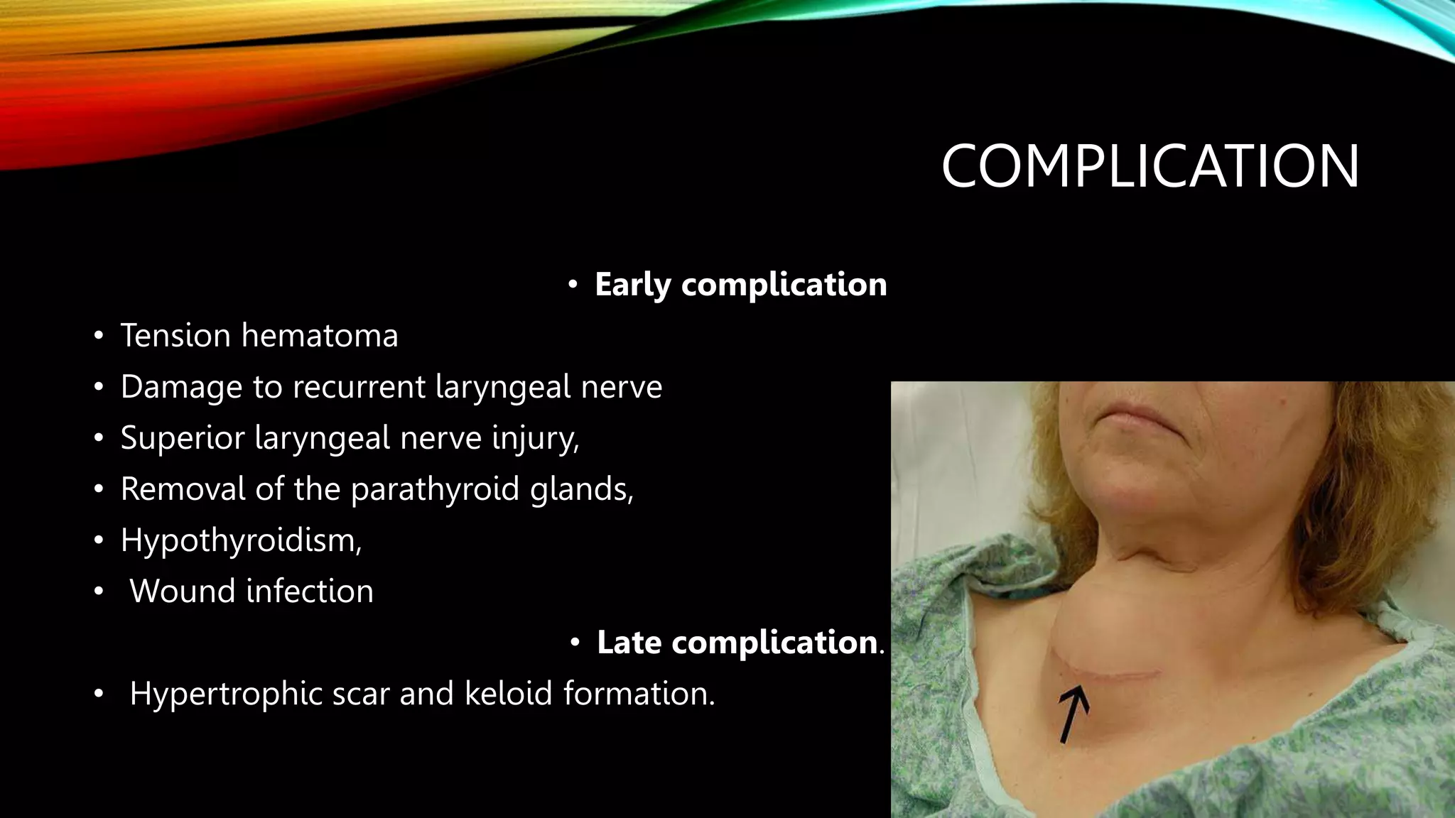 thyroidectomy.pptx