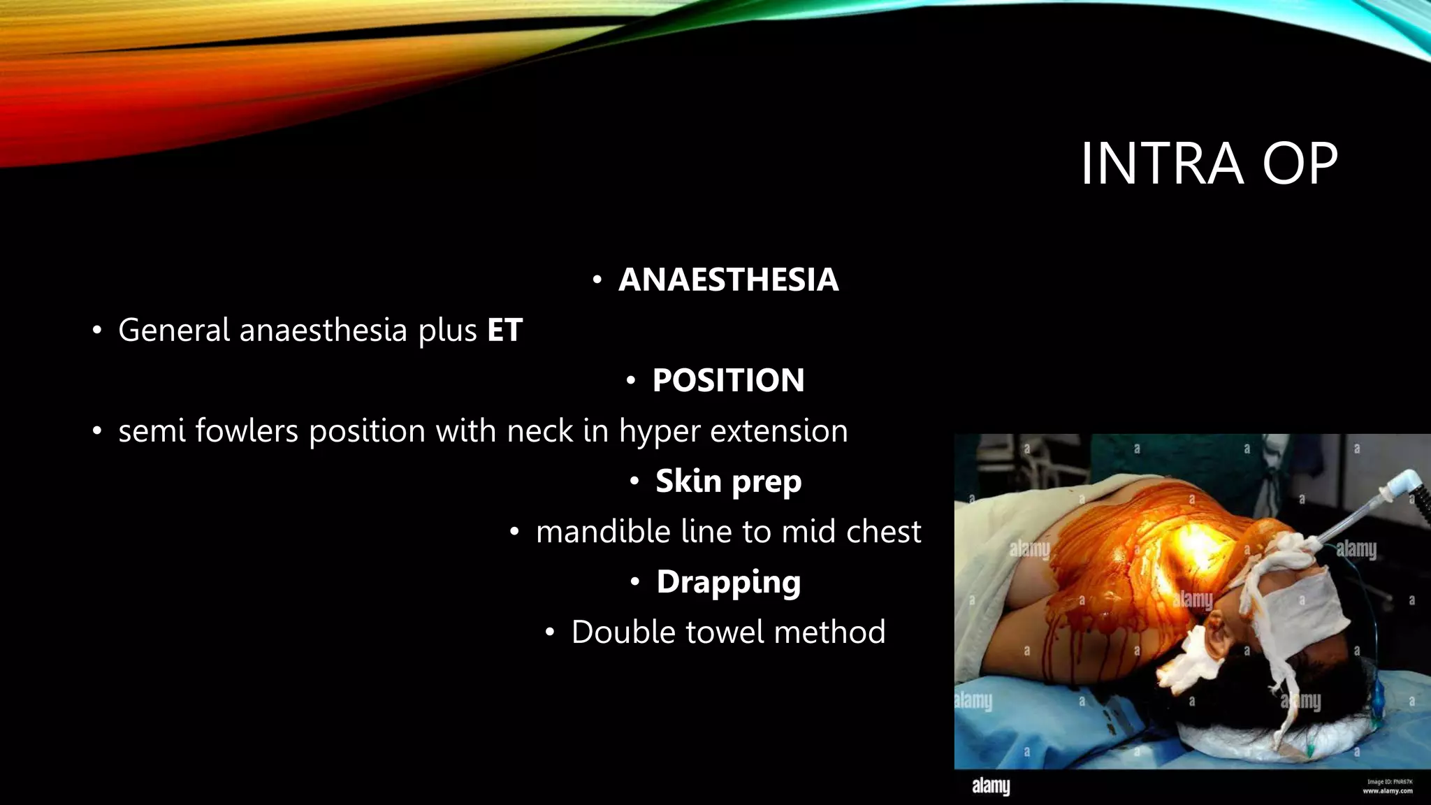 thyroidectomy.pptx