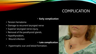 thyroidectomy.pptx | Thyroid Disorders | Endocrine and Metabolic Diseases