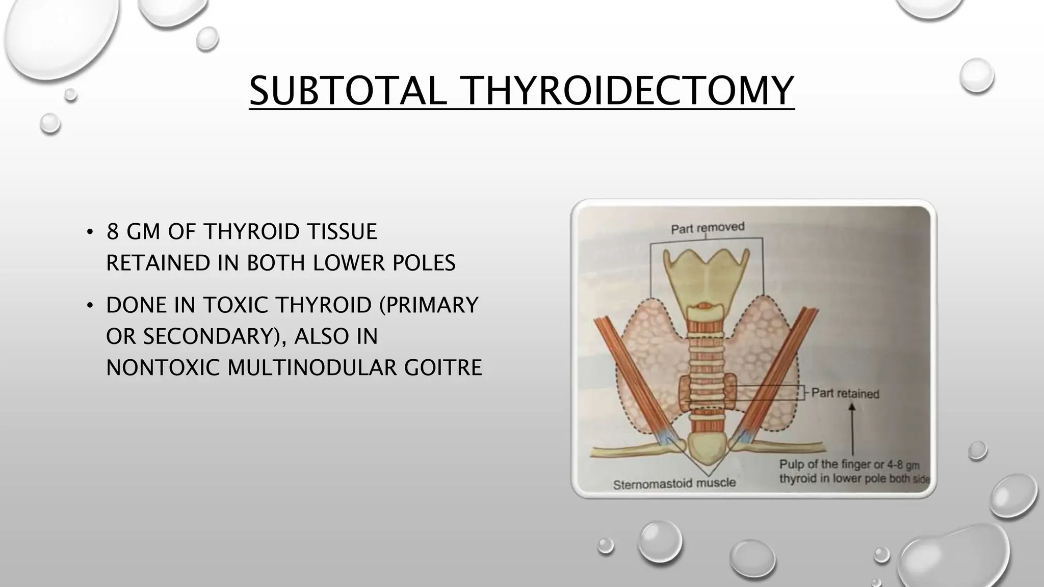 THYROIDECTOMY.pptx
