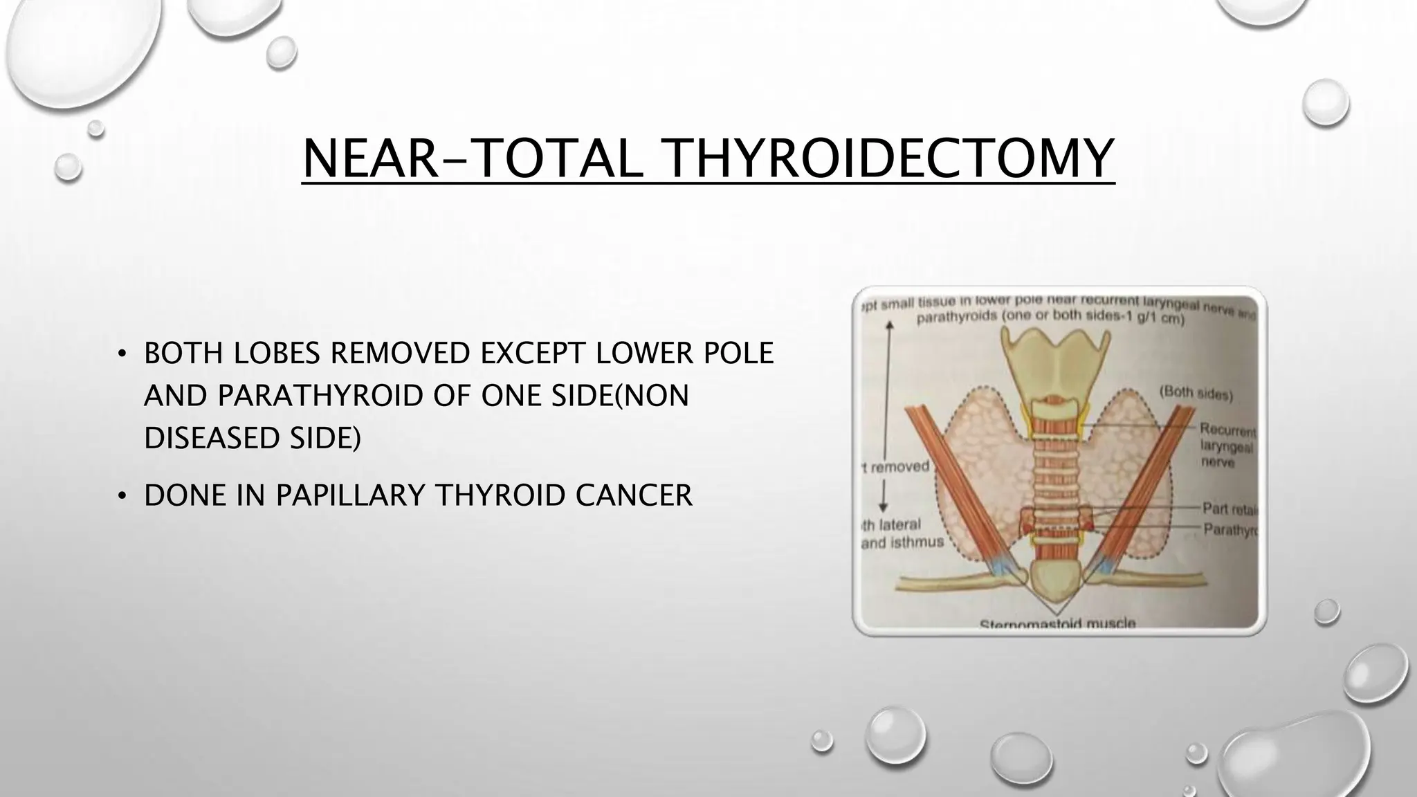 THYROIDECTOMY.pptx