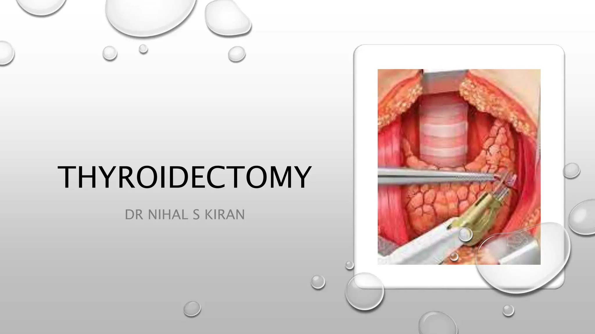THYROIDECTOMY.pptx