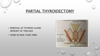 THYROIDECTOMY.pptx