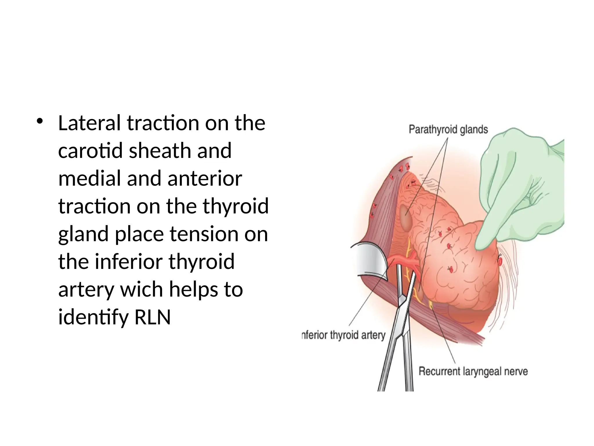 Thyroidectomy .pptxTechniques of Thyroidectomy.ppt