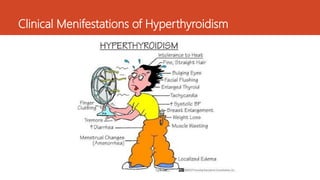 Perioperative Management of Hyperthyroidism with Goitre for Total ...