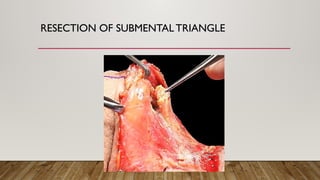 Thyroidectomy presentation for medical students | PPTX