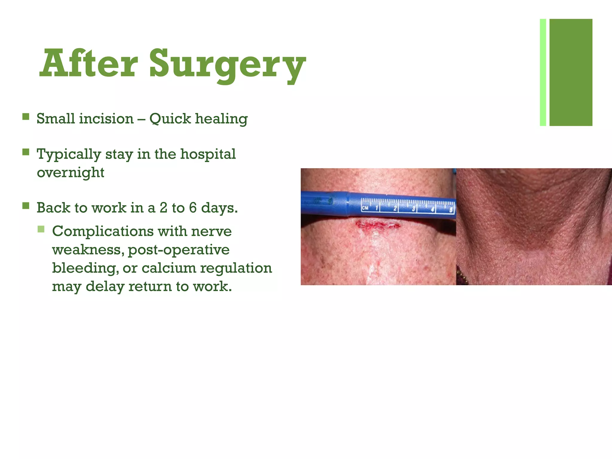 gytThyroidectomy and-reconstructive-eye-surgery | PPT