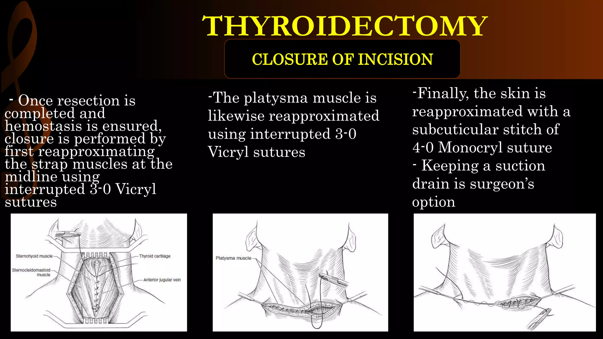 Thyroidectomy- operative surgery | PPTX