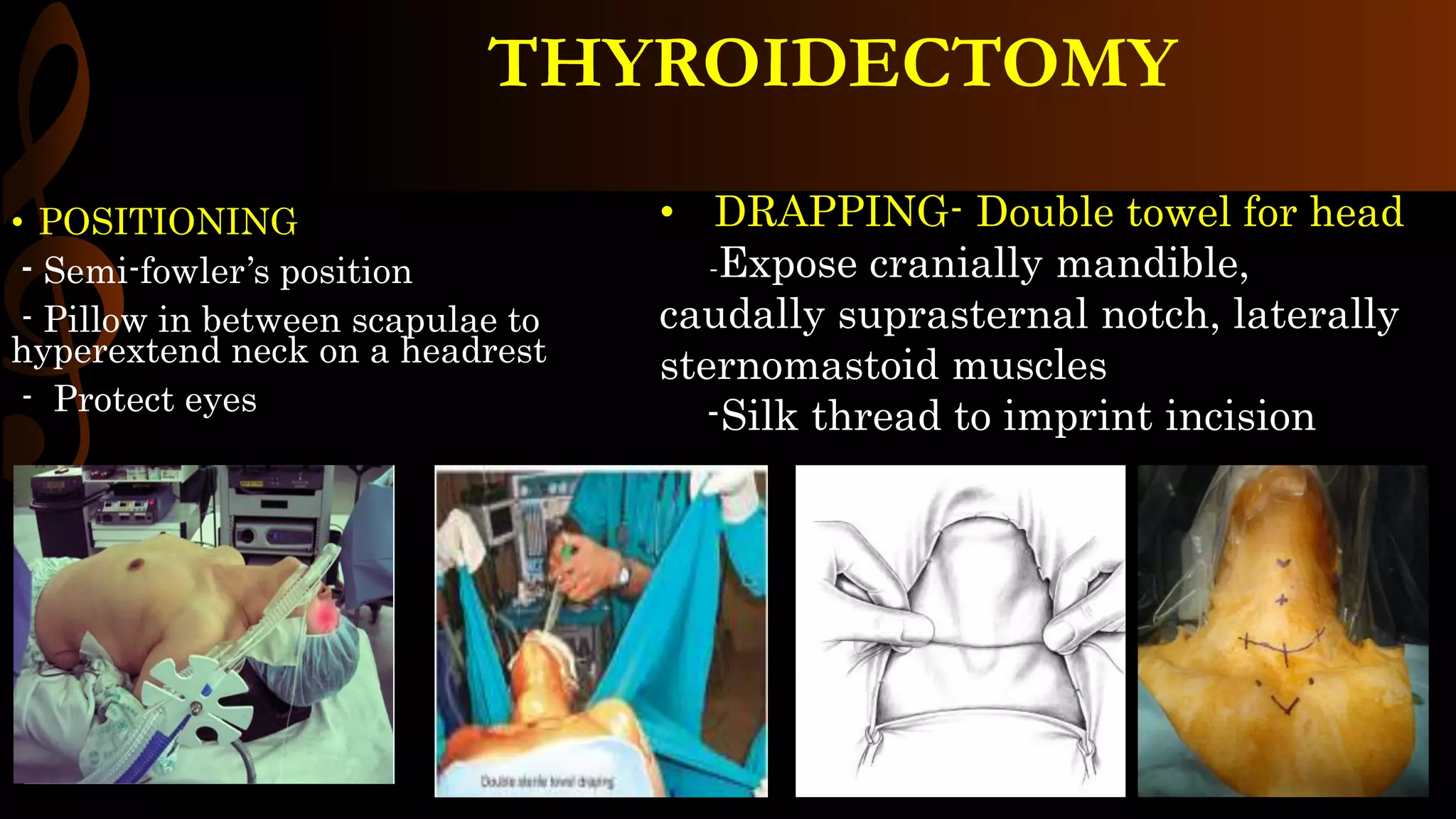 Thyroidectomy- operative surgery | PPTX