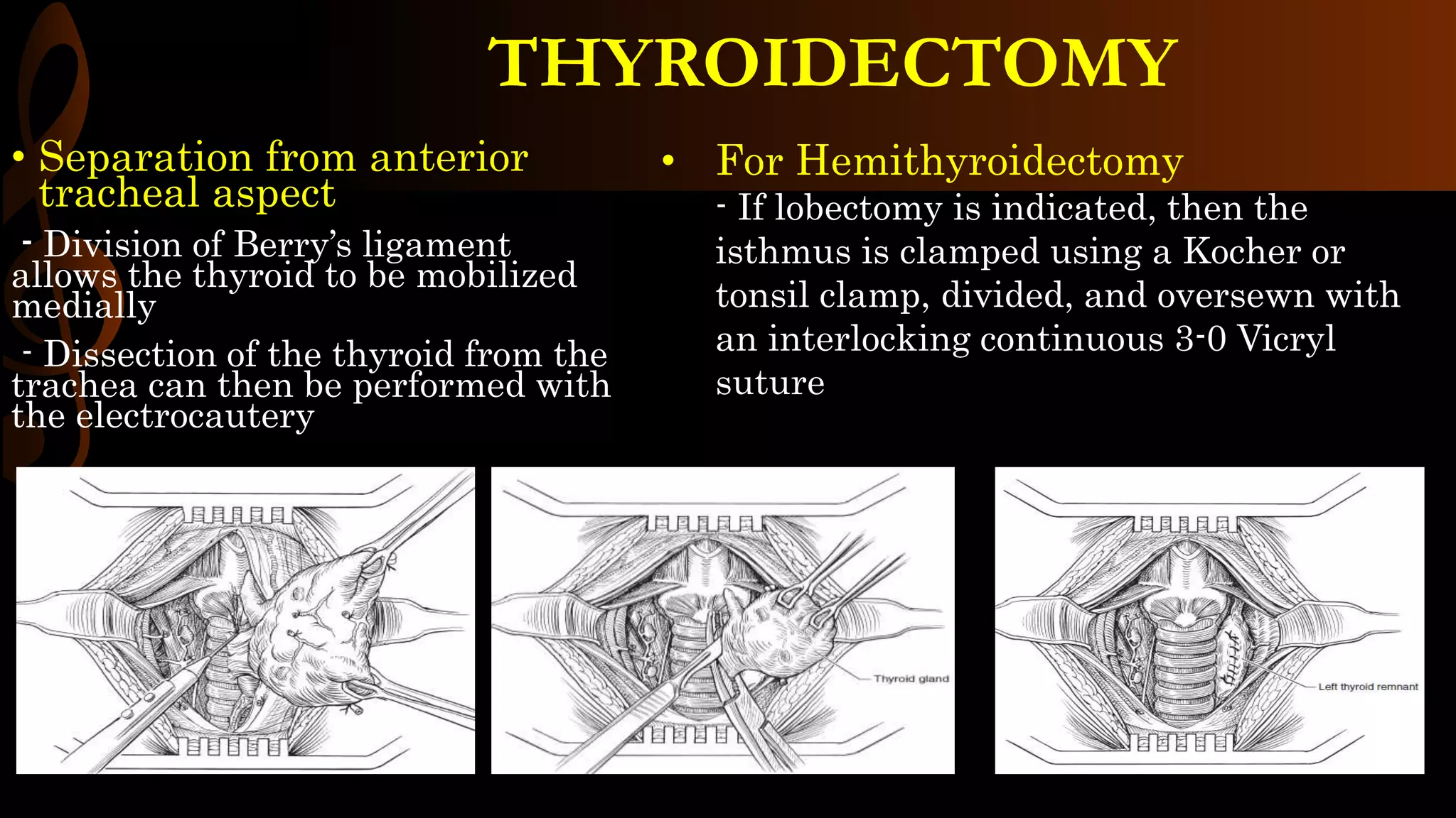 Thyroidectomy- operative surgery | PPTX