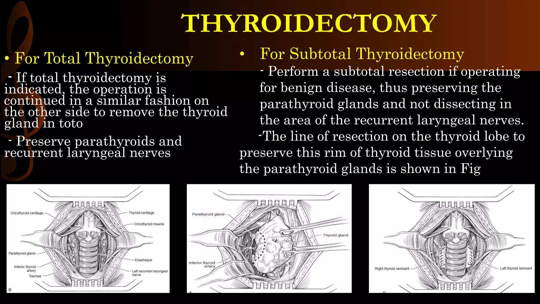 Thyroidectomy- operative surgery | PPTX