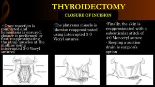 Thyroidectomy- operative surgery | PPTX
