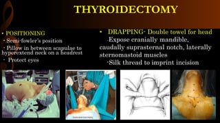 Thyroidectomy- operative surgery | PPTX