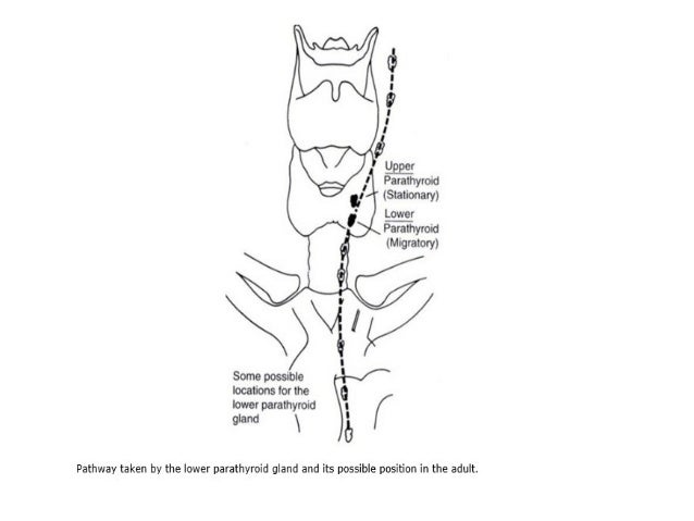Thyroidectomy