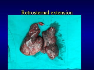Types and technique of Thyroidectomy lecture.ppt