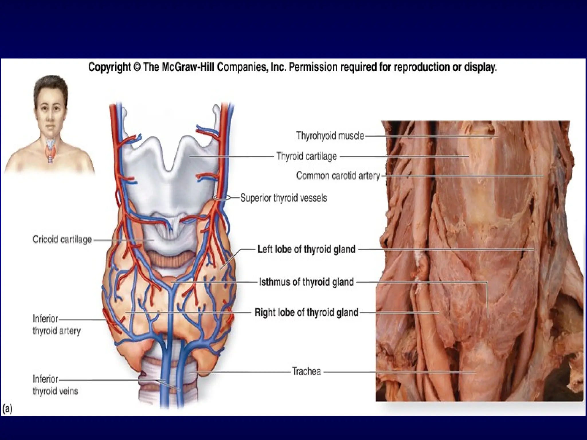 Detailed Technique Of Thyroidectomy Ppt