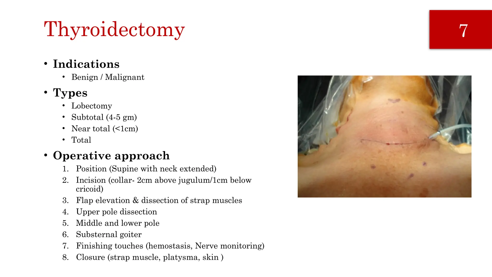 Thyroidectomy minilik seminar.pptTechniques of Thyroidectomy ...