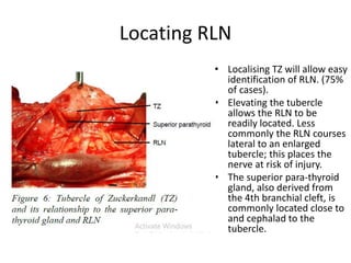 thyroidectomy notes.pptx